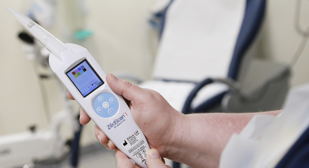 Zilico device increases cervical cancer detection by up to 24 per cent ...