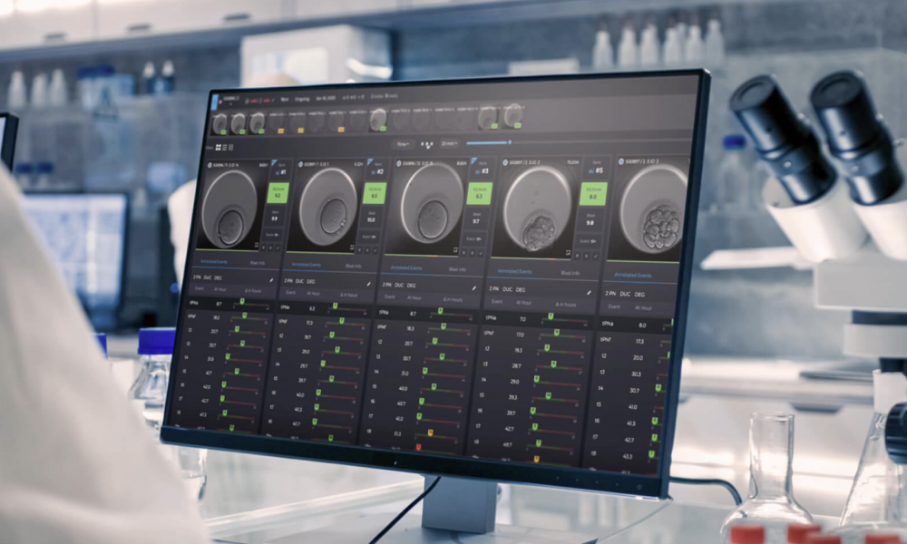DotLab research highlights need for endometriosis test - FemTech World