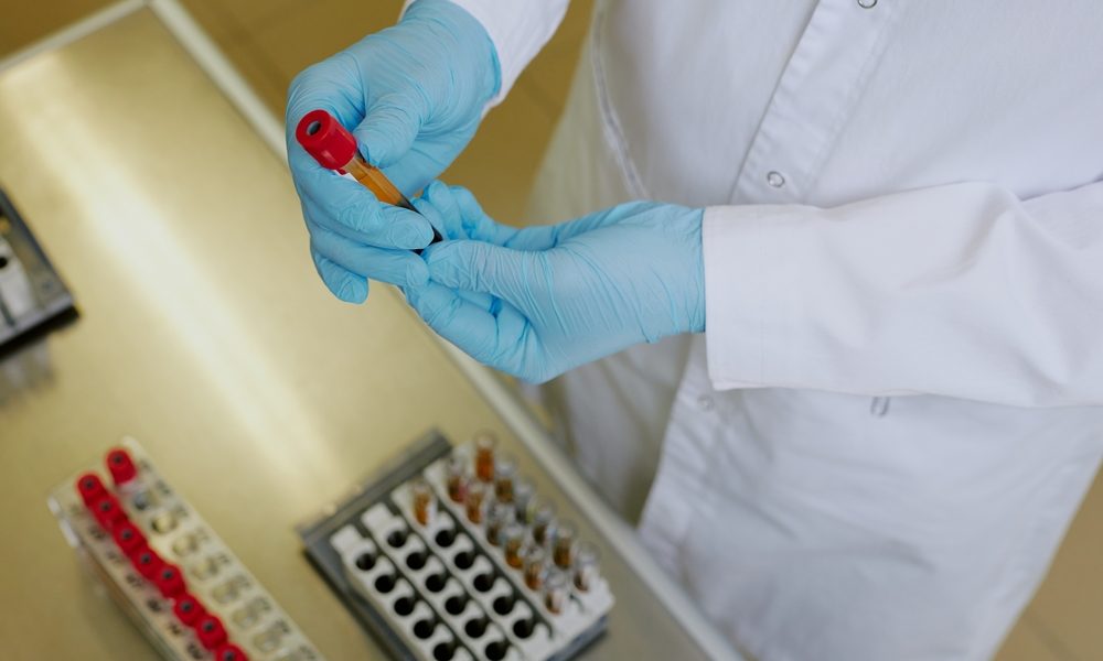 Proseek Bio raises AU$1.5m for ovarian cancer blood test