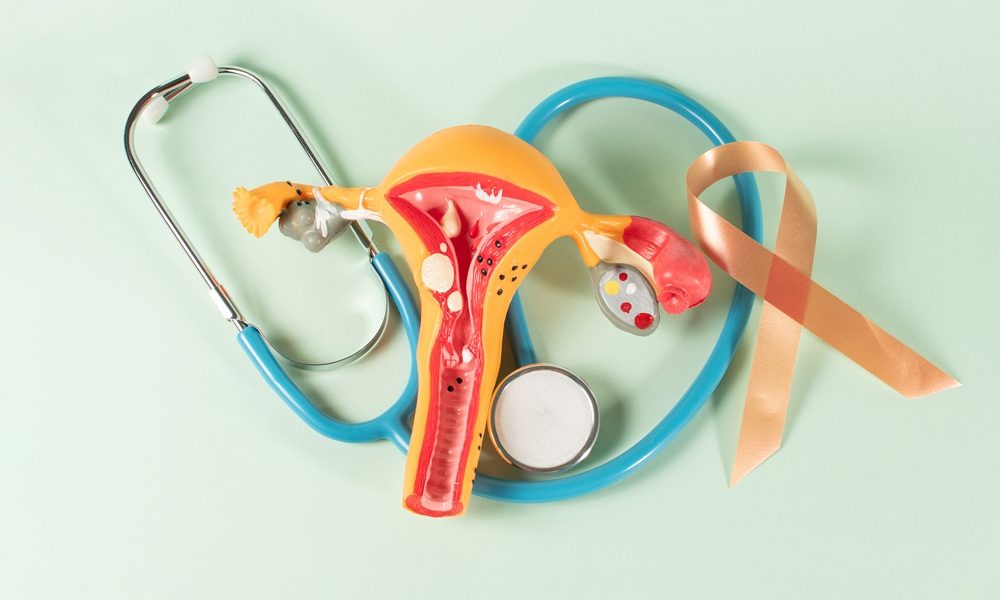 AI could transform ovarian care through personalisation, study finds